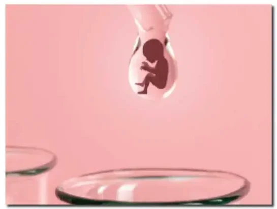 tesa-pesa-sperm-retrieval-procedures-and-techniques